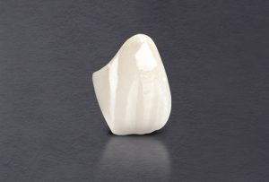 IPS e.max® – Dental Arts Laboratories