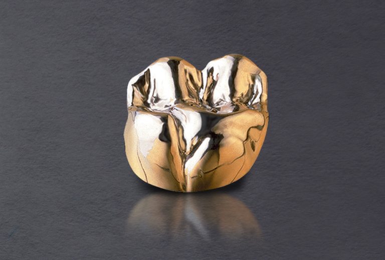 Full Cast Crown – Dental Arts Laboratories